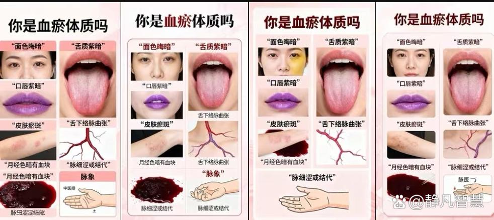 紫脉强度排名一览表图标
