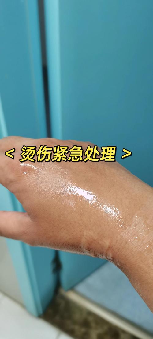 手机屏幕被开水烫了一下会坏吗图标