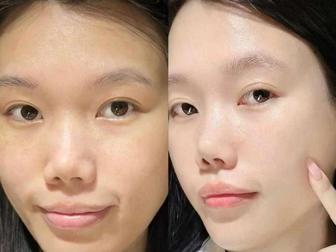 脸越来越黄了怎么办截图