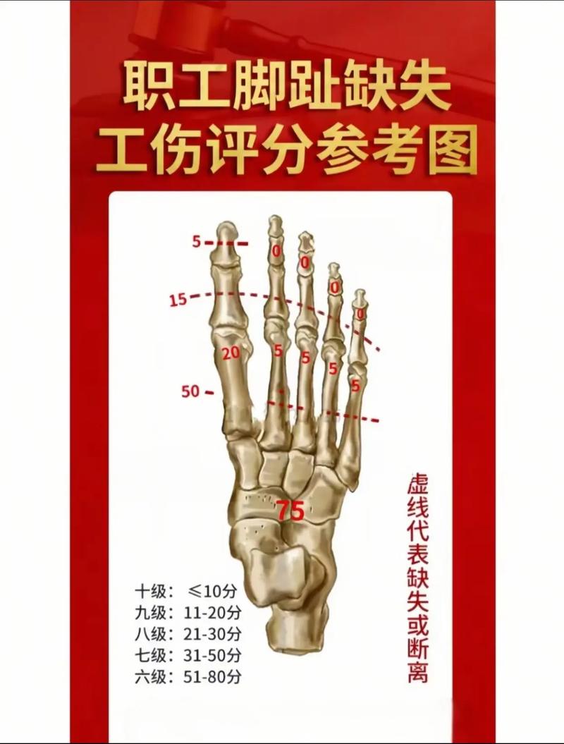 脚趾头骨折是几级伤残图标