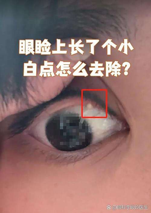 华为手机屏幕上的白点怎么去掉图标