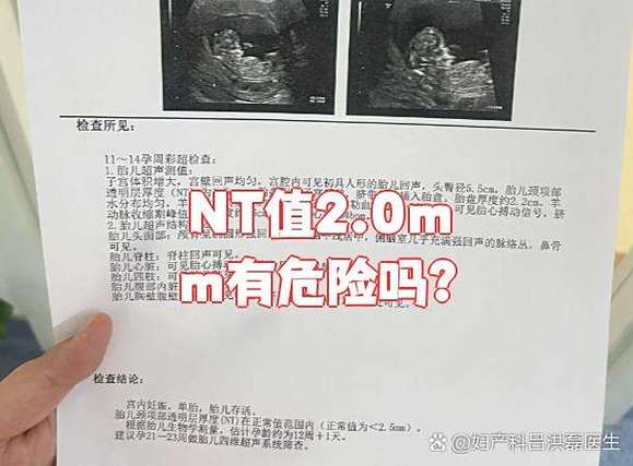 nt值2.8mm很严重吗?图标
