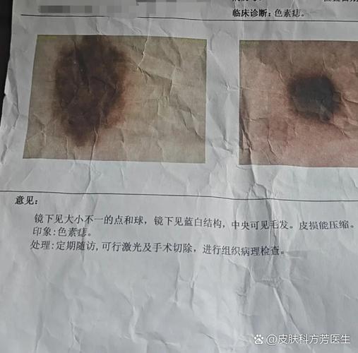 小米手机屏幕上有黑色的斑点图标