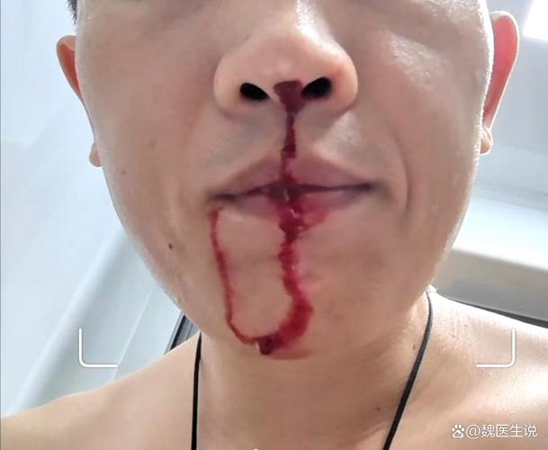 让男人流鼻血的照片图标