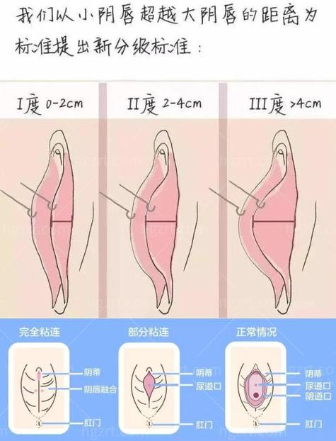手机号码显示私密电话图标