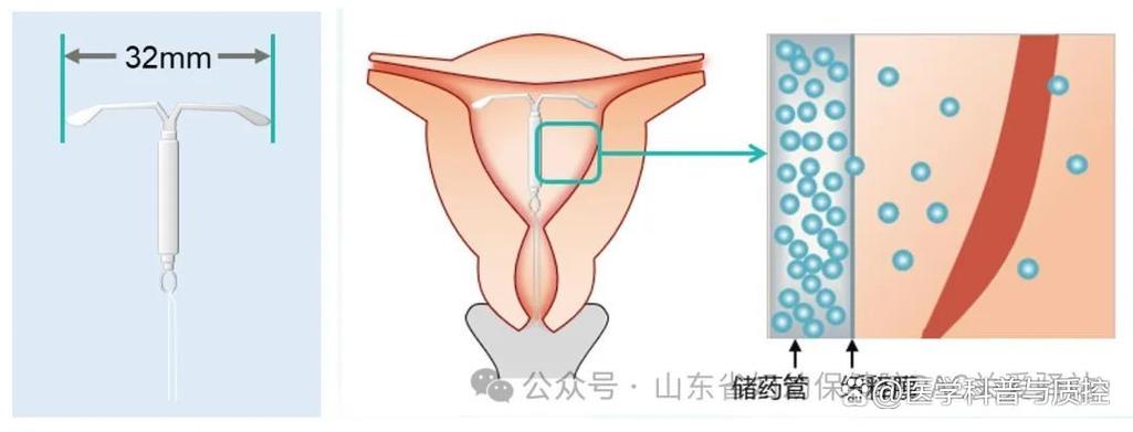 曼月乐环长什么样图标