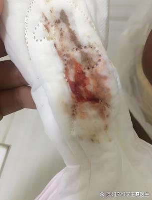 以前月经很少这次突然多了图标