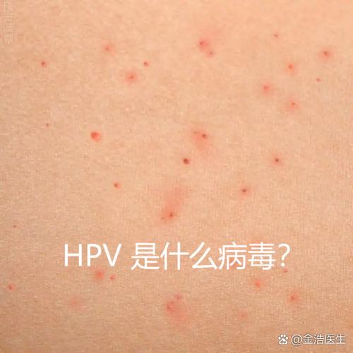 性传染的病毒有哪几种截图