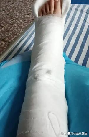 伤筋了不管它会自愈吗截图