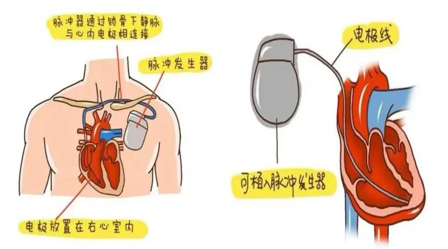 临时降低心率的最快方法图标
