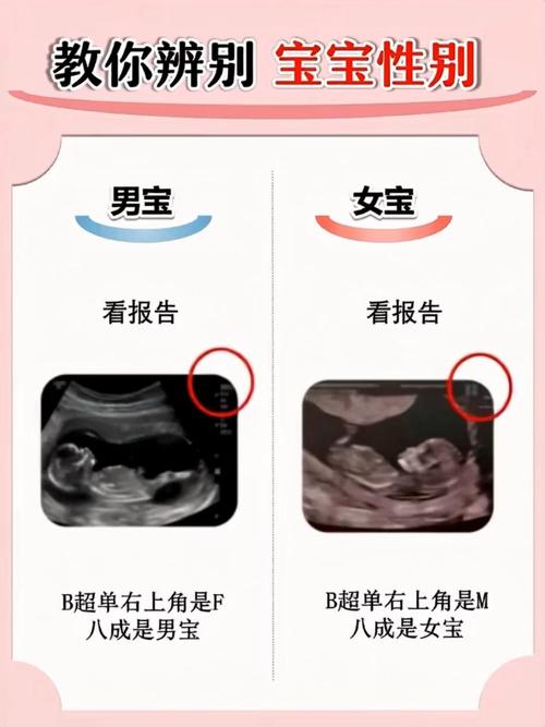 人类幼崽是男孩还是女孩图标