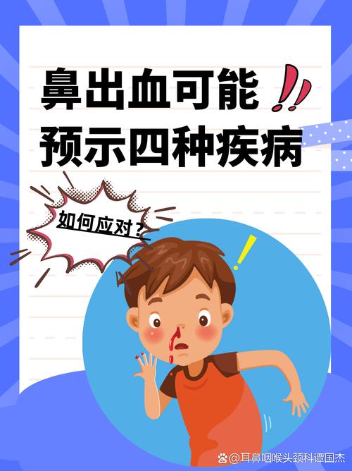 经常流鼻血是什么病的前兆图标