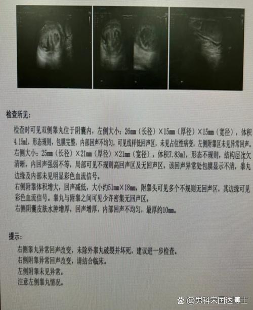 睾丸勒坏图标