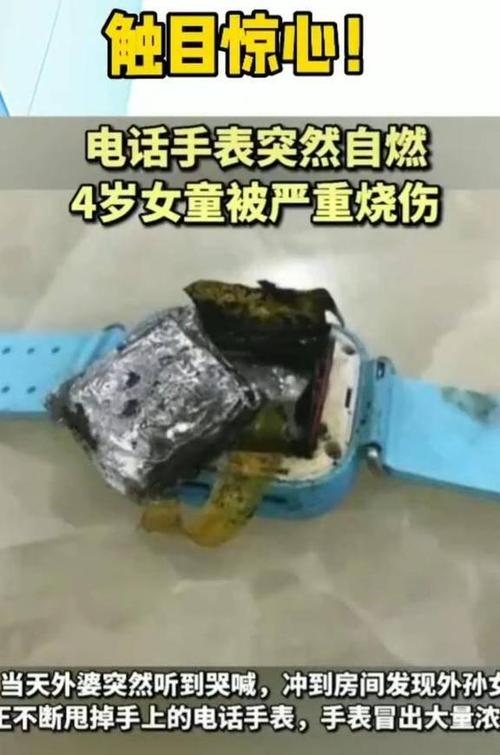 智能手表爆炸伤儿童图标