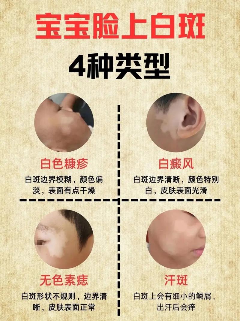 皮肤起白斑点是什么原因图标