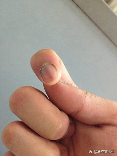 手机屏幕雾蒙蒙的有竖纹是怎么回事截图