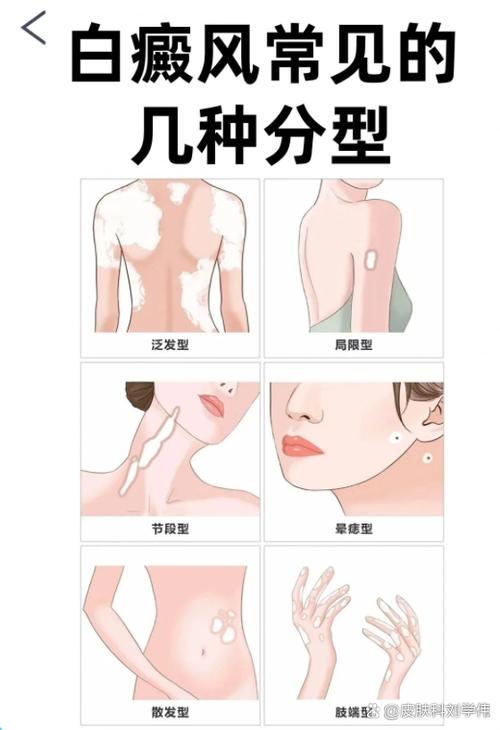 皮肤分几个等级