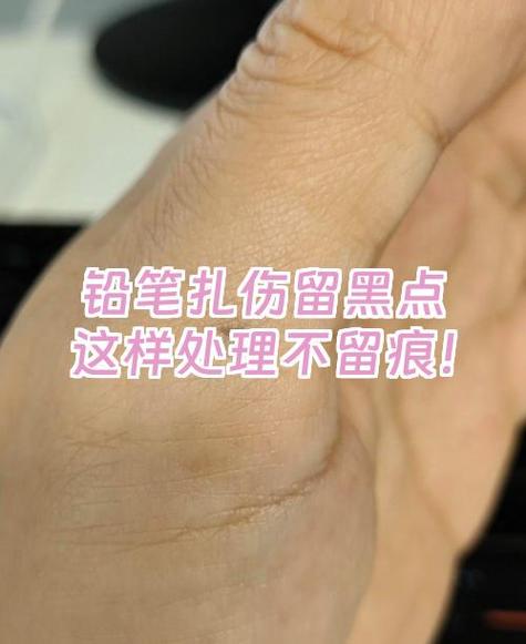 打印机打出来有很多黑点截图
