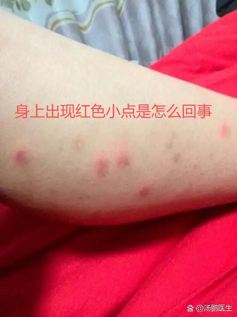 皮肤上起红色的小点图标