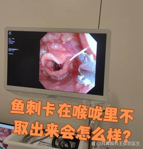舌头根部扎鱼刺的危害图标