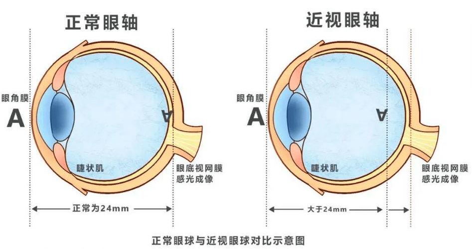 5.0和5.1哪个视力好图标