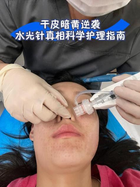 40岁女人打水光针有用吗图标