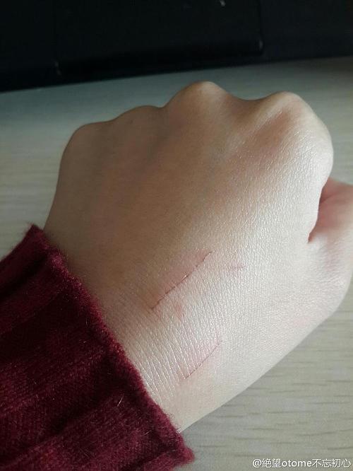 被小猫抓了几条白色印子