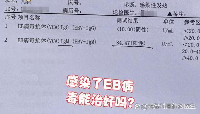 eb病毒能治好吗图标