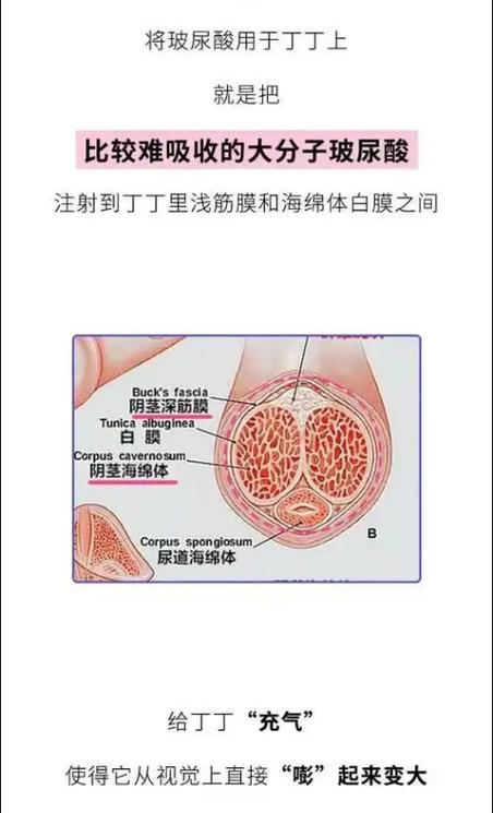 丁丁打玻尿酸能管用多久图标