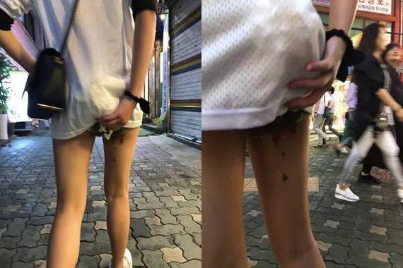 女士大便憋不住拉裤子截图