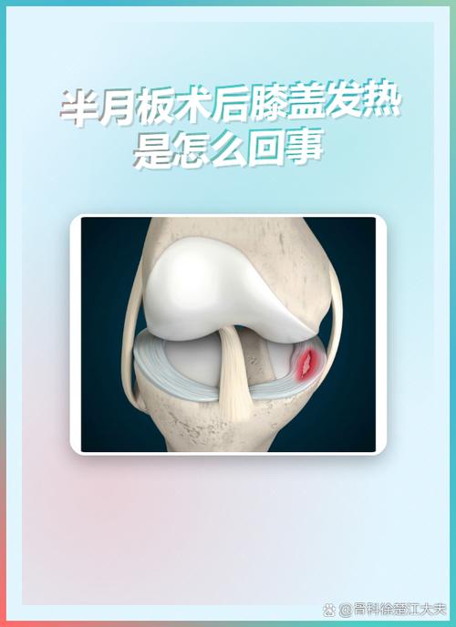 膝盖发热的常见原因图标