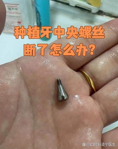 断螺丝取出器图标