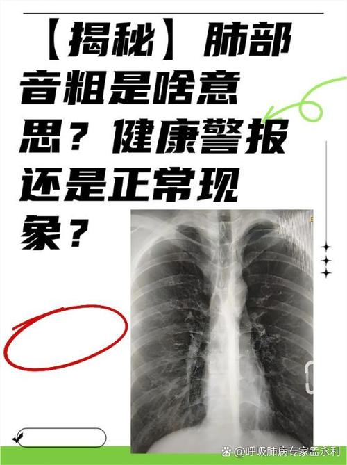 声音太粗怎么改变图标