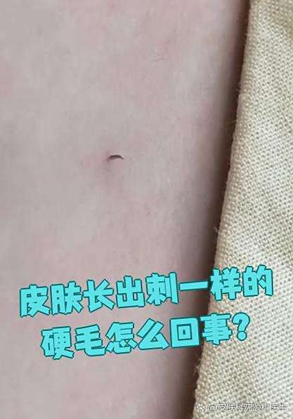 手掌上长了像针尖的小硬刺图标