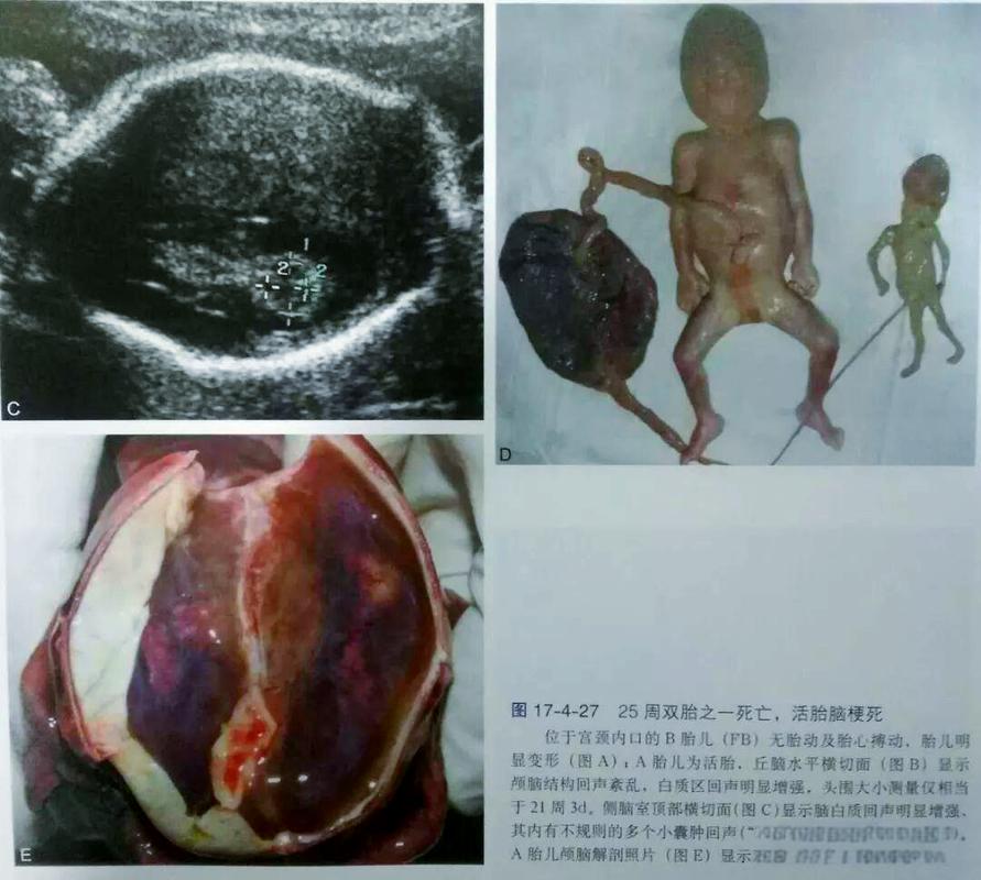 死胎蛋的图片100张图标
