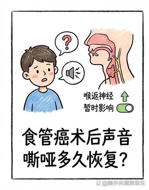 总是不受控制的发出声音截图