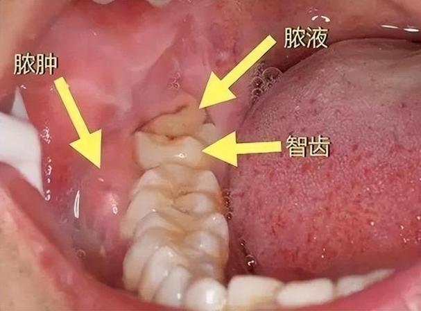 智齿图标