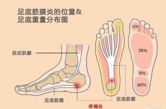 左脚前脚掌疼怎么治疗图标