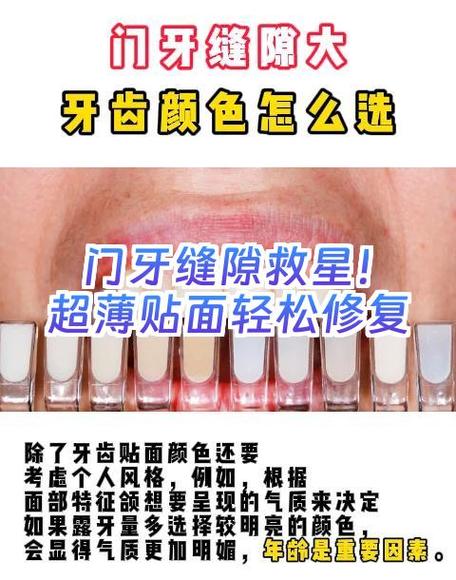 戴尔电脑自动修复无法修复你的电脑图标
