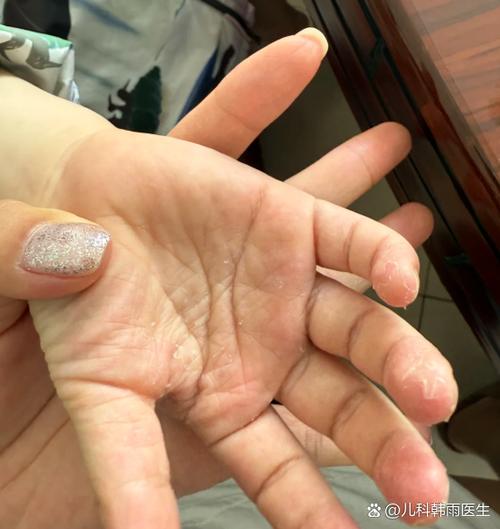 点头是什么原因导致的截图