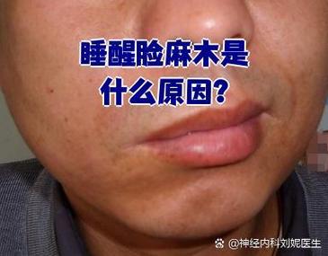 脸部发麻是什么原因