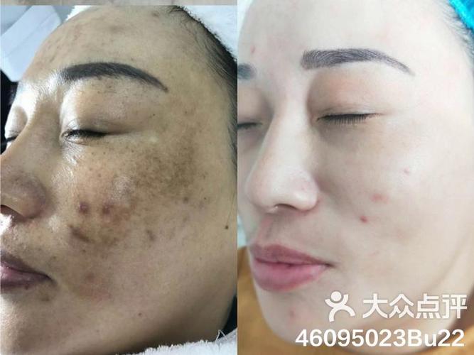 美容院细胞净化是什么