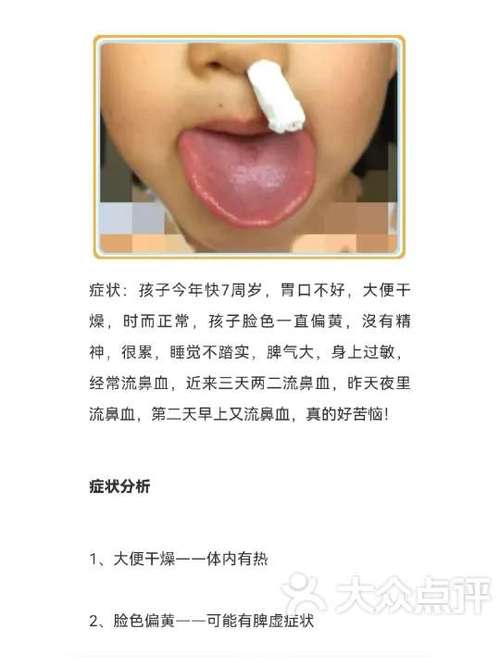 治小孩流鼻血的土偏方图标