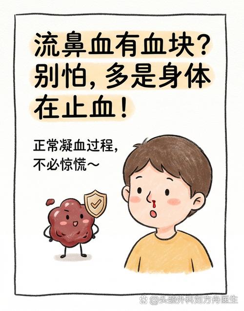 流鼻血血块怎么弄出来图标