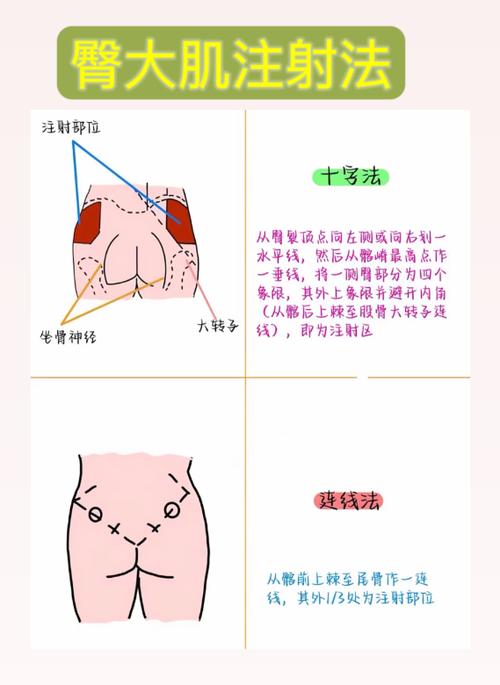 打屁股针的方法图标