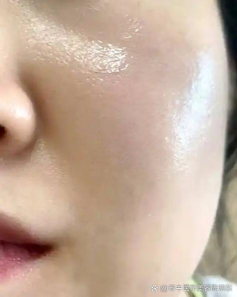 脸歪不对称怎么矫正过来截图