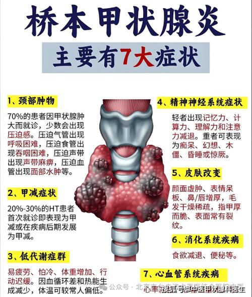 桥本甲状腺炎和hpv感染有关系吗截图