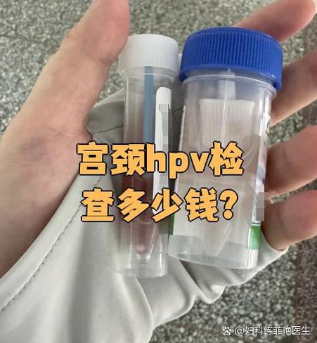 宫颈活检大概多少钱截图