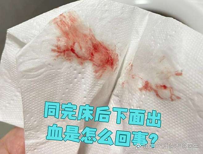 同房后出了一点血正常吗图标
