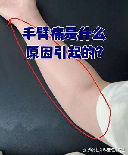 左臂酸困无力怎么回事截图